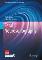 First-Trimester Fetal Brain | Springer Nature Link