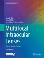 The Johnson and Johnson IOL: Eyhance | Springer Nature Link