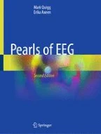 The Normal Electroencephalogram of Sleep | Springer Nature Link