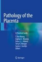 Chronic Deciduitis | Springer Nature Link