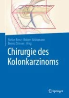 Linke Kolonflexur: Onkologische Resektion und Varianten in der ...