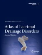 Dacryoscintigraphy | Springer Nature Link