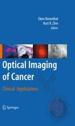 Optical Imaging of Cancer: Clinical Applications | SpringerLink