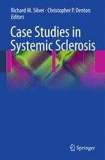 Case Studies in Systemic Sclerosis | SpringerLink