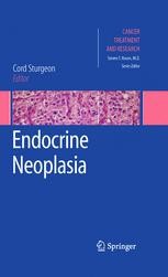 Endocrine Neoplasia | SpringerLink