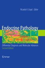 Endocrine Pathology:: Differential Diagnosis and Molecular Advances ...