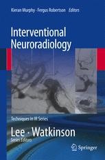 Interventional Neuroradiology | SpringerLink