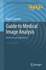 Guide to Medical Image Analysis: Methods and Algorithms | SpringerLink