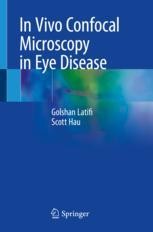In Vivo Confocal Microscopy in Eye Disease | SpringerLink