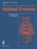 Spinal Fusion: Science and Technique | SpringerLink