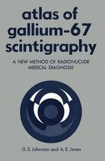 Atlas of Gallium-67 Scintigraphy: A New Method of Radionuclide Medical ...