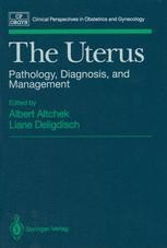 The Uterus: Pathology, Diagnosis, and Management | SpringerLink
