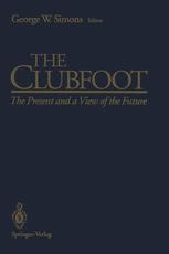 The Clubfoot: The Present and a View of the Future | SpringerLink