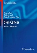 Skin Cancer: A Practical Approach | SpringerLink