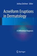 Acneiform Eruptions in Dermatology: A Differential Diagnosis | SpringerLink