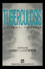 Tuberculosis | SpringerLink