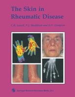 The Skin in Rheumatic Disease | SpringerLink
