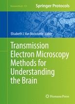 Transmission Electron Microscopy Methods for Understanding the Brain | SpringerLink
