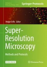 Super-Resolution Microscopy: Methods and Protocols | SpringerLink