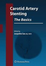 Carotid Artery Stenting: The Basics | Springer Nature Link (formerly ...