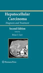 Hepatocellular Carcinoma: Diagnosis and Treatment | SpringerLink