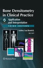 Bone Densitometry in Clinical Practice: Application and Interpretation ...
