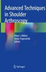 Advanced Techniques in Shoulder Arthroscopy | Springer Nature Link ...
