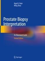 Prostate Biopsy Interpretation: An Illustrated Guide | SpringerLink