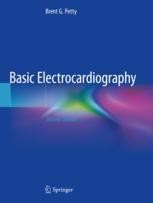 Basic Electrocardiography | Springer Nature Link (formerly SpringerLink)