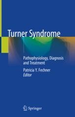 Turner Syndrome: Pathophysiology, Diagnosis and Treatment | SpringerLink