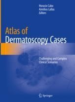 Atlas of Dermatoscopy Cases: Challenging and Complex Clinical Scenarios ...