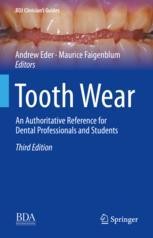Tooth Wear: An Authoritative Reference for Dental Professionals and ...