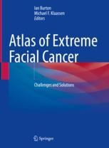 Atlas of Extreme Facial Cancer: Challenges and Solutions | SpringerLink