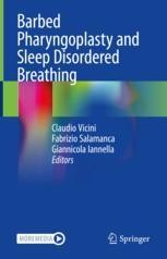Barbed Pharyngoplasty and Sleep Disordered Breathing | SpringerLink