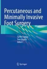 Percutaneous and Minimally Invasive Foot Surgery | SpringerLink
