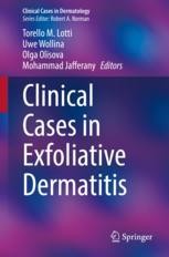 Clinical Cases in Exfoliative Dermatitis | SpringerLink