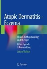 Atopic Dermatitis - Eczema: Clinics, Pathophysiology and Therapy ...