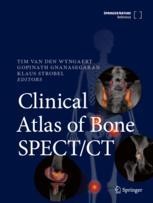 Common Variants and Pitfalls: Bone Island (Enostosis) | Springer Nature ...