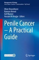 Penile Cancer – A Practical Guide | SpringerLink