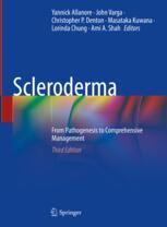 Scleroderma: From Pathogenesis to Comprehensive Management | SpringerLink