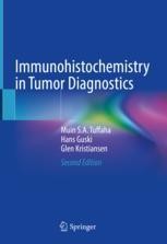 Immunohistochemistry in Tumor Diagnostics | SpringerLink