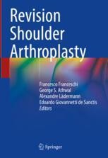 Revision Shoulder Arthroplasty | SpringerLink