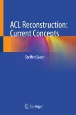 ACL Reconstruction: Current Concepts | SpringerLink