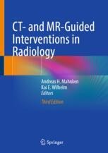 CT- and MR-Guided Interventions in Radiology | Springer Nature Link