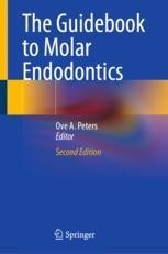 The Guidebook to Molar Endodontics | Springer Nature Link