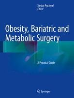 Obesity, Bariatric and Metabolic Surgery: A Practical Guide | SpringerLink