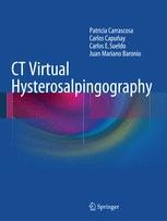 CT Virtual Hysterosalpingography | Springer Nature Link