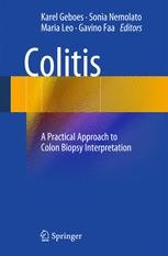 Colitis: A Practical Approach to Colon Biopsy Interpretation | SpringerLink