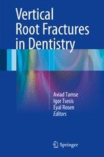Vertical Root Fractures in Dentistry | SpringerLink