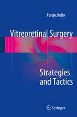 Vitreoretinal Surgery: Strategies and Tactics | Springer Nature Link ...